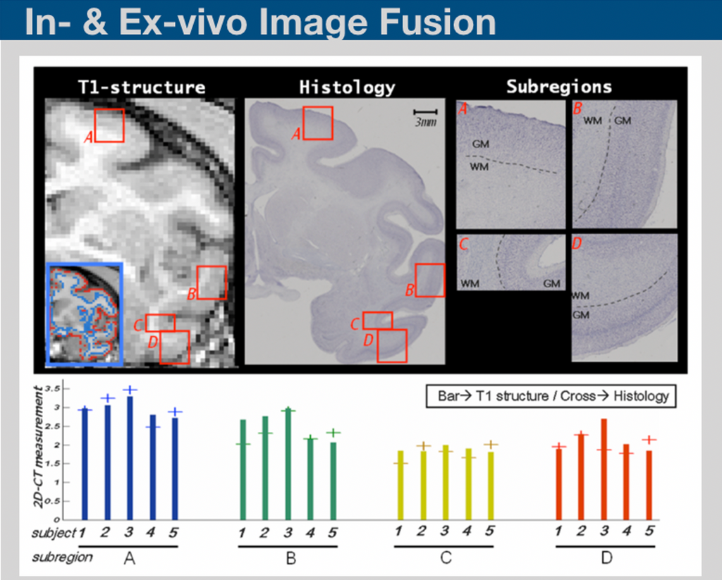 Research | Bio-Imaging & Informatics Lab