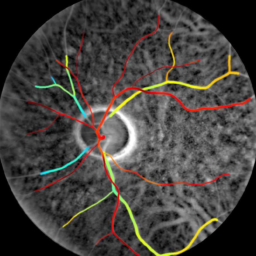 Transcranial retinal imaging | Biomicroscopy Lab
