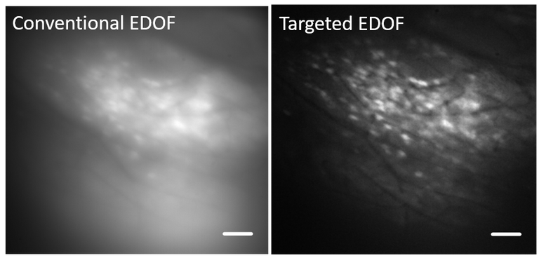 Extended-depth-of-field microscopy | Biomicroscopy Lab