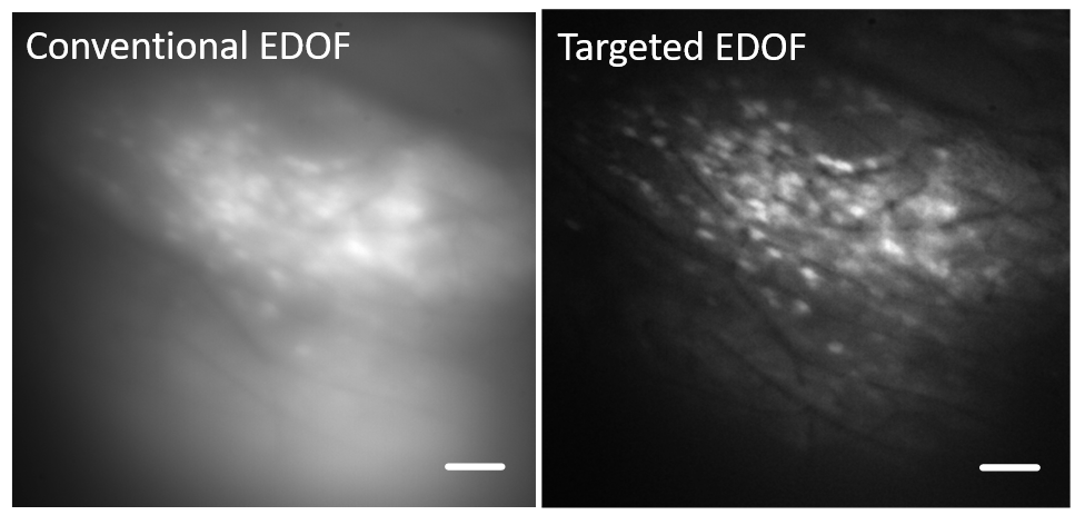 Extended-depth-of-field microscopy | Biomicroscopy Lab