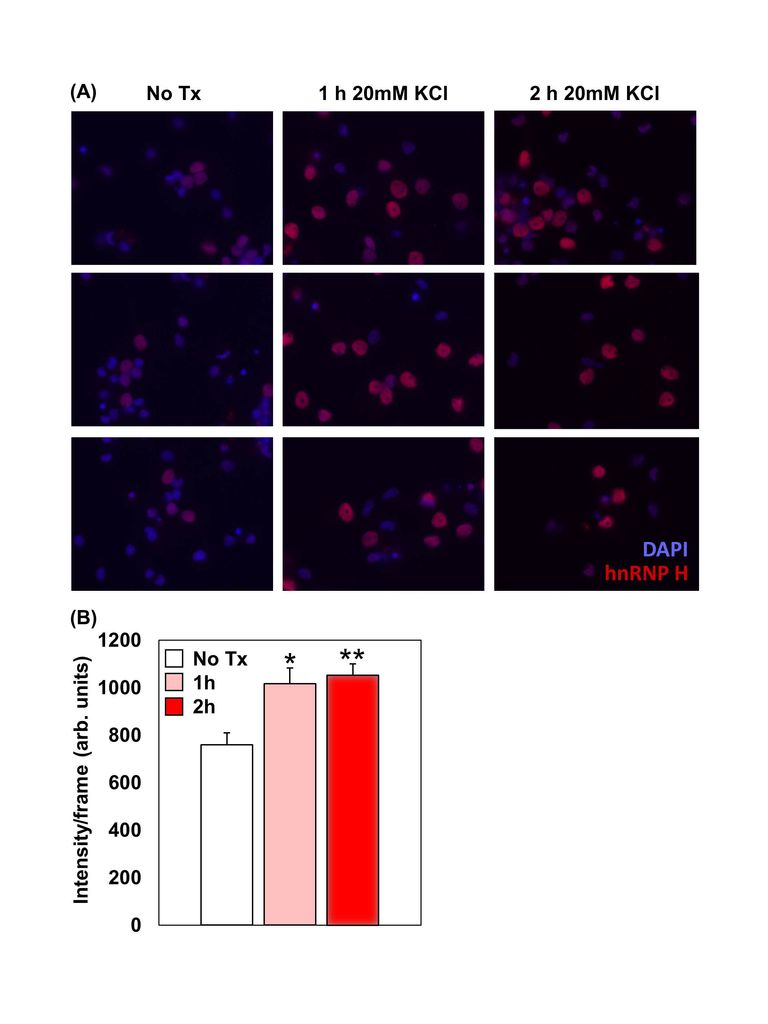 Immunohistochemical staining of hnRNP H following KCl depolarization in ...
