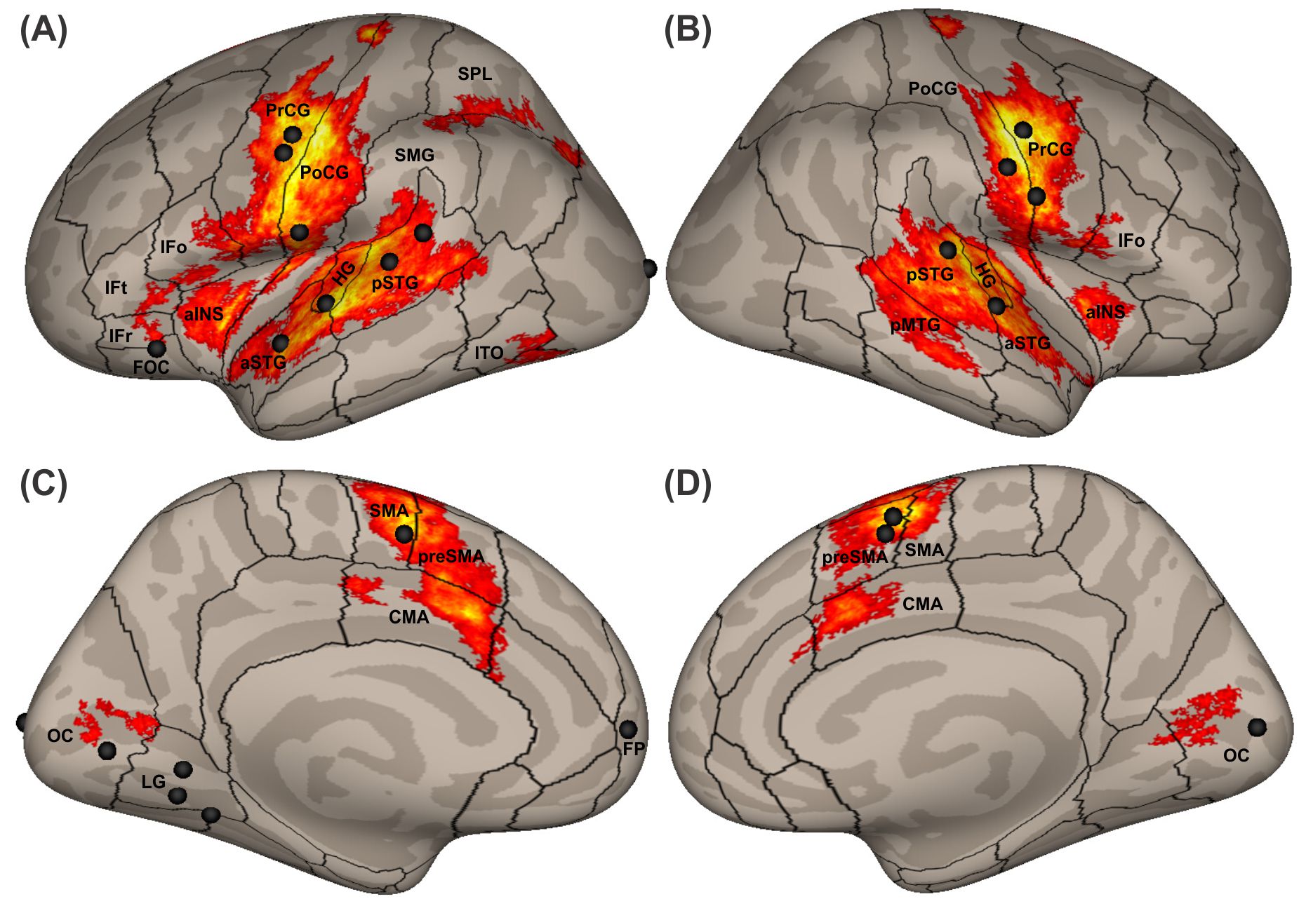 Functional Neuroimaging of Speech | Guenther Lab
